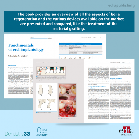Bone regeneration in implantology: tooth as a graft - Dentistry book